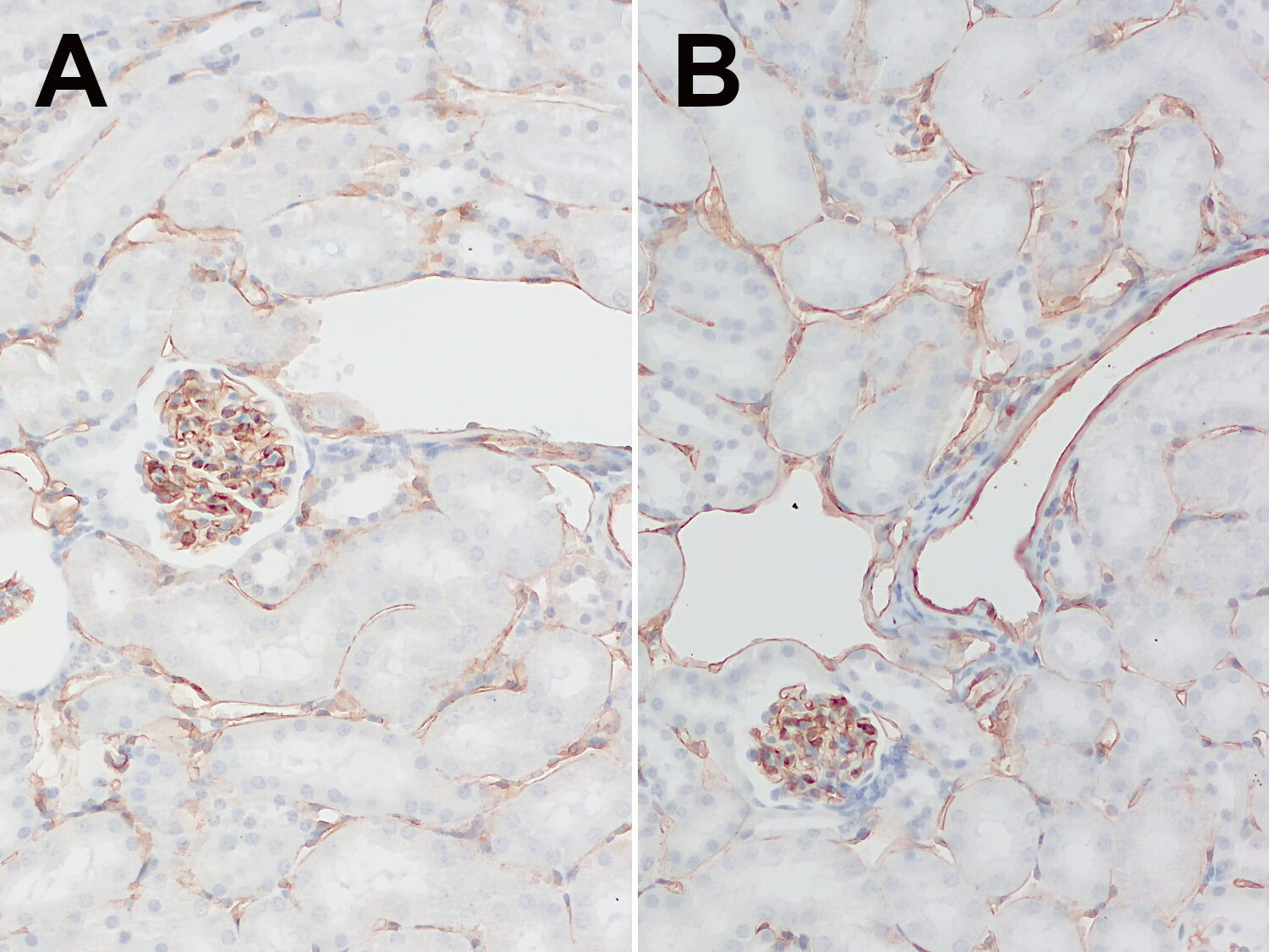 CD31 as marker for endothelial cells